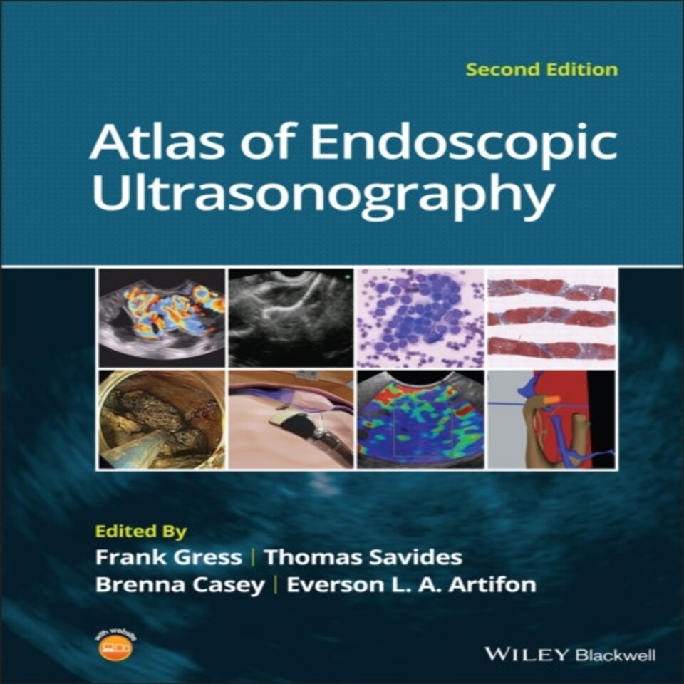 Atlas Of Endoscopic Ultrasonography - Tesco Groceries