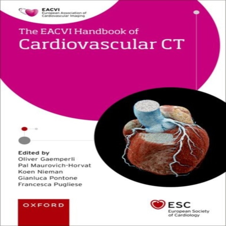 Eacvi Handbook Of Cardiovascular Ct - Tesco Groceries
