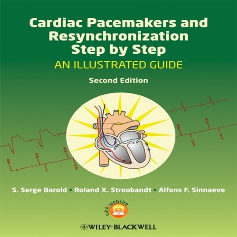Cardiac Pacemakers And Resynchronization Therapy Step-by-step - Tesco ...